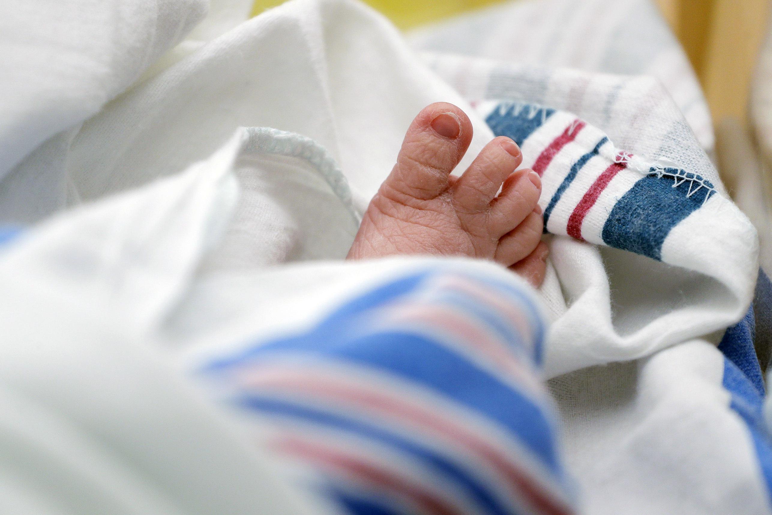 Syphilis in newborns signals bigger problems in U.S. health system